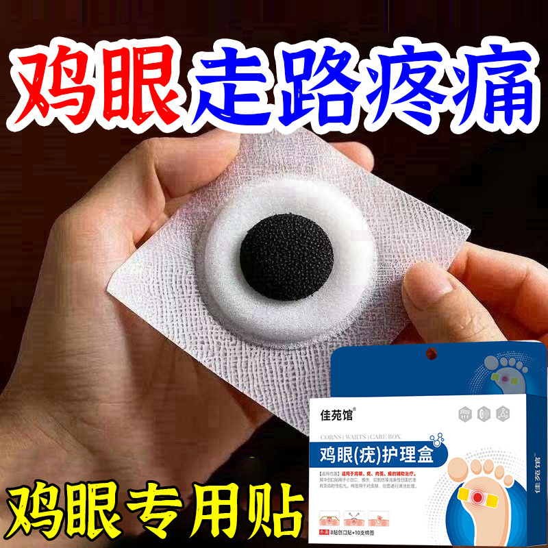 New Product Ready Stock Hand-Foot Corn Calluses Metatatatarsal Wart ...