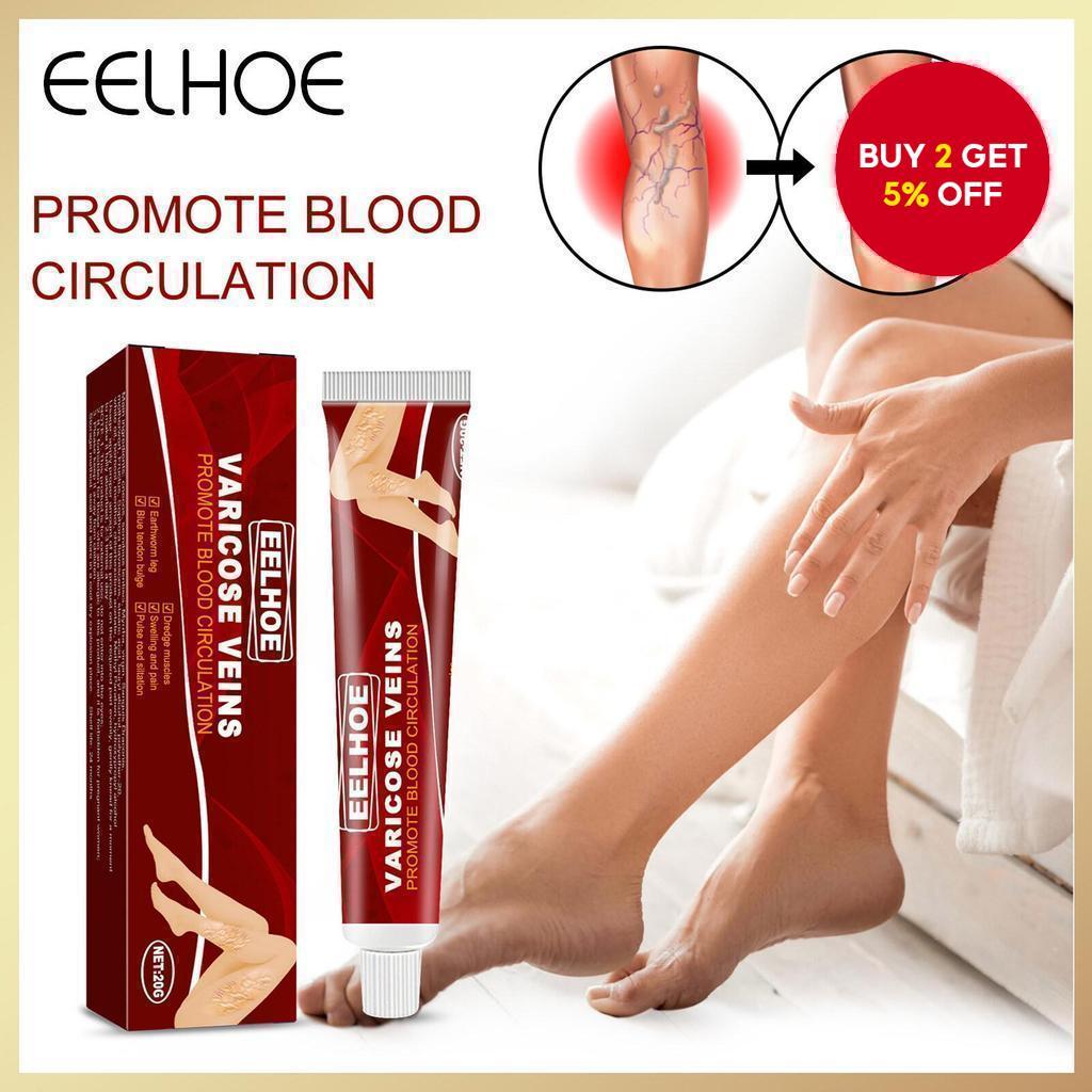 Varicose Vein Cream Venous Massage Ointment Earthworm Leg Inflammation ...