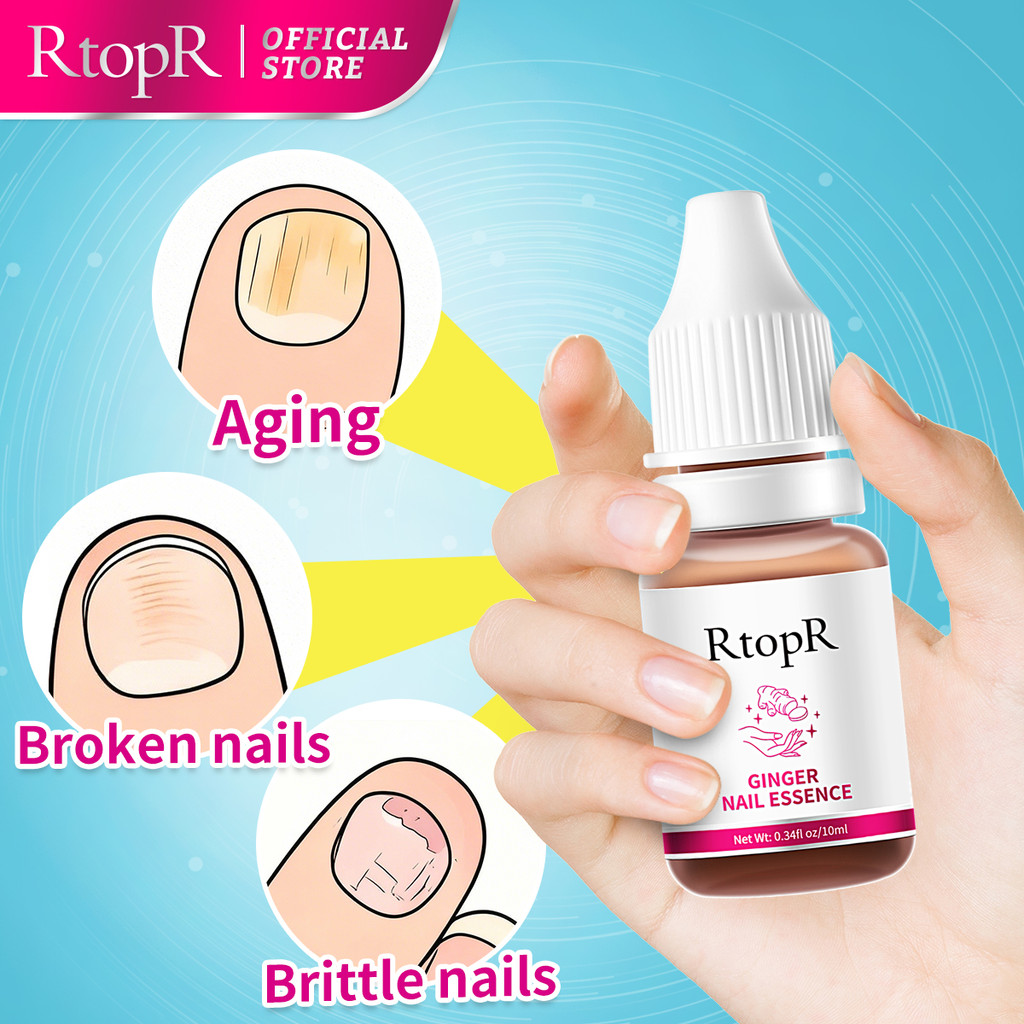 RtopR Ginger Antibacterial Nail Treatment Essential Anti Fungal ...
