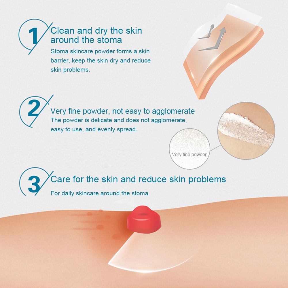 Reeopee 10Pcs 20-65mm Disposable Colostomy Bag Urostomy Bag Drainable ...