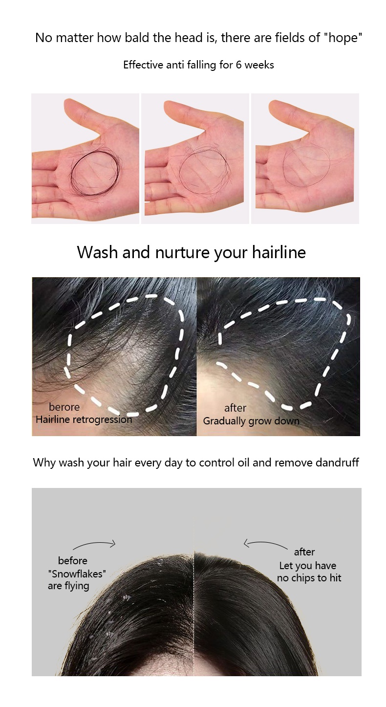 AZLA Ginger Hair Shampoo Fast Regrowth Hair Thick Anti-Hair Loss Anti ...