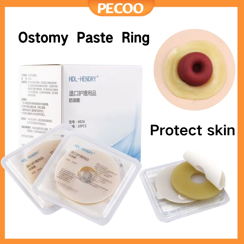 2/5/10Pcs Ostomy Paste Ring Baseplates Stoma Leakproof Ring Leakage ...