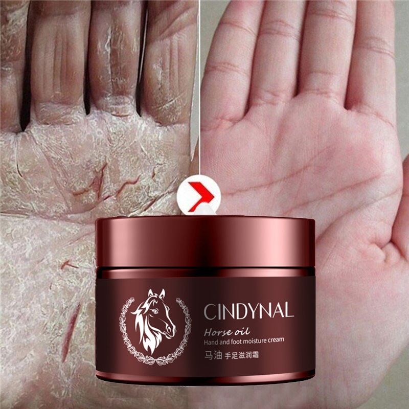 CINDYNAL Milebel Horse Oil Foot Cream Anti Dry Heel Repair Cream 110g ...