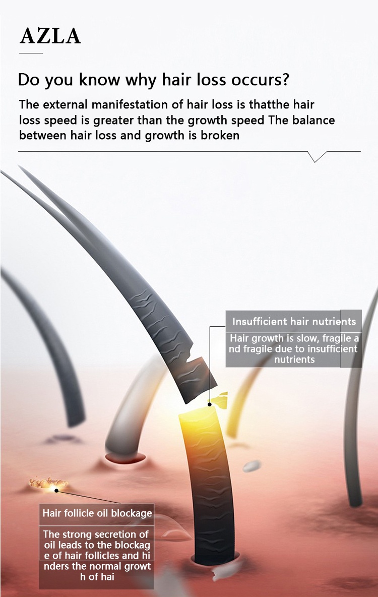 AZLA Ginger Hair Shampoo Fast Regrowth Hair Thick Anti-Hair Loss Anti ...