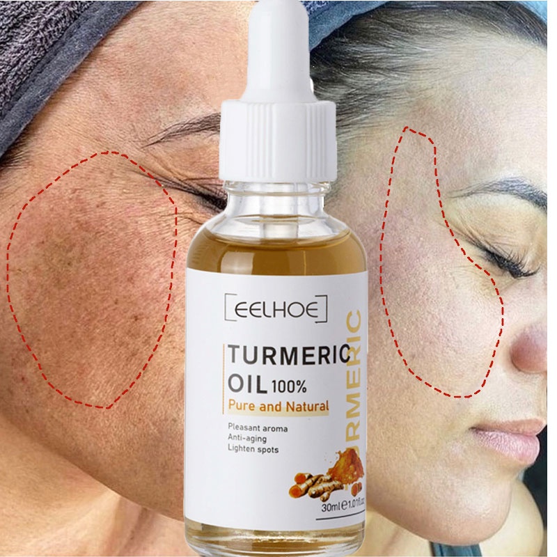 EELHOE Turmeric Freckle Whitening Serum Curcumin Oil Brighten Fade Dark ...