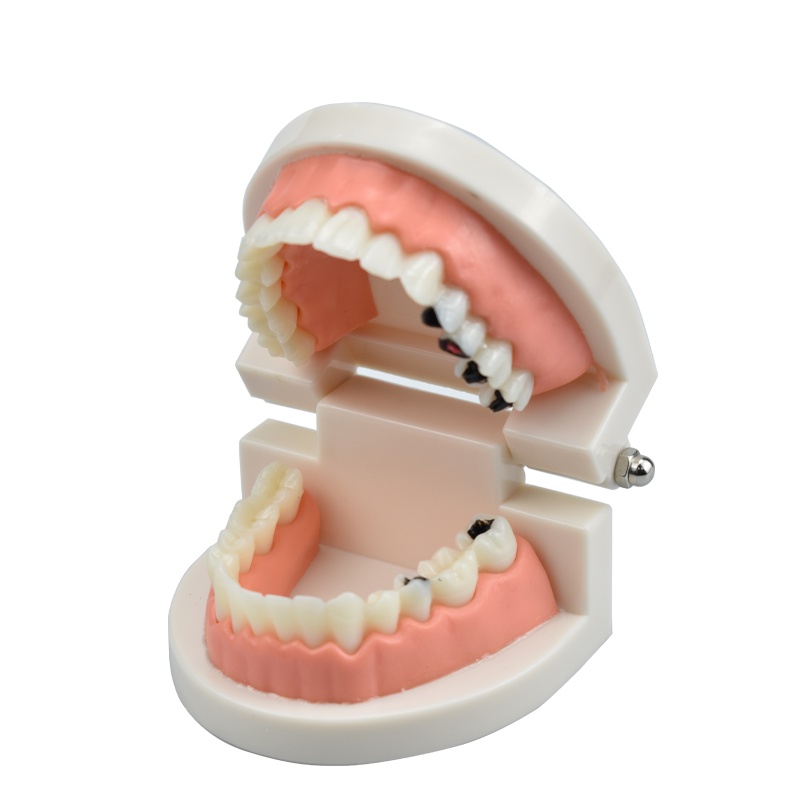Teeth Model Children Kid Teaching Study Demonstration Tooth Model ...