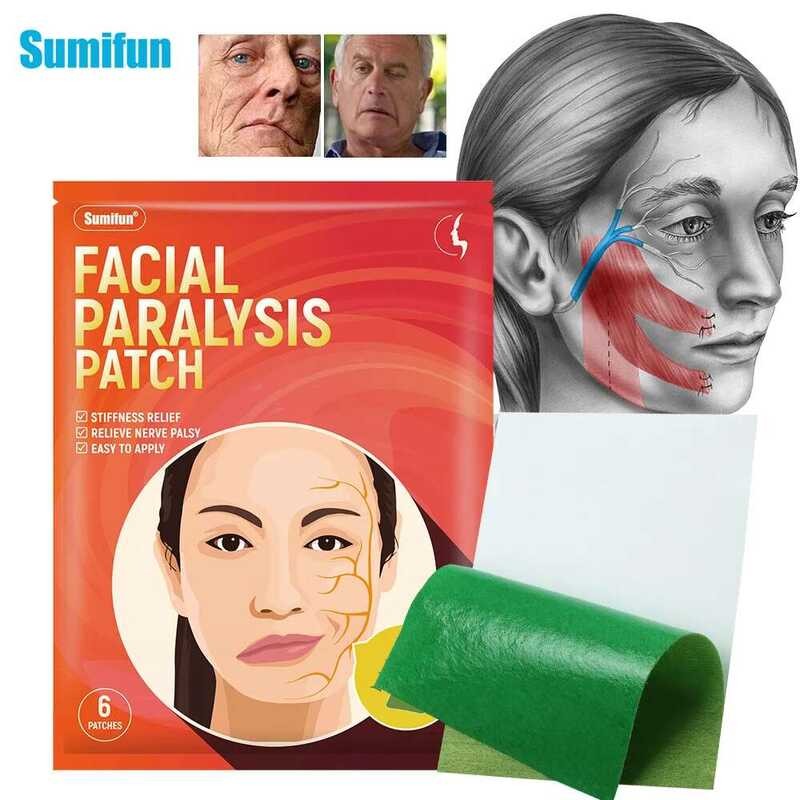 Tt Sumifun Mouth Crooked Eye Oblique Nerve Muscle Facial Paralysis ...
