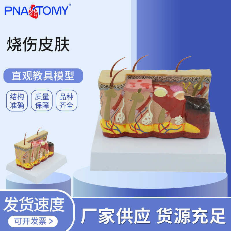 Burn 3D Medical Human Skin 1 Structure Teaching Aid Simulation Model ...