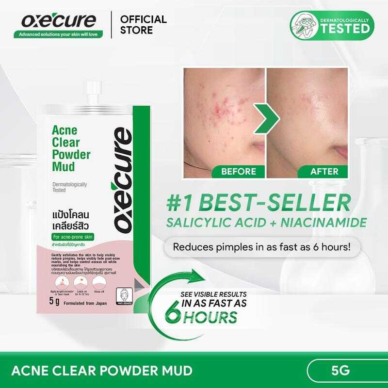 OXECURE 2% Salicylic Acid Acne Clear Powder Mud 5G [Pimples, Blackheads ...