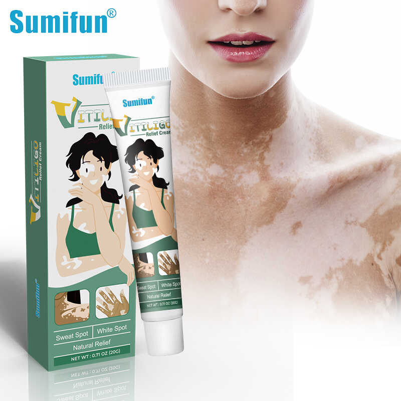 Tt Sumifun Vitiligo Treatment Cream White Spot Skin Removal Ointment ...