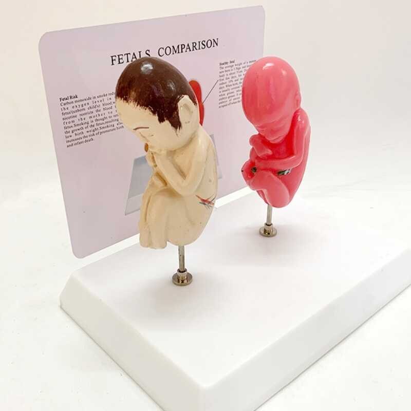 Tt Pagbabahagi Sangkatauhan Na Bayad, Pagpapakita Anatomya At ...