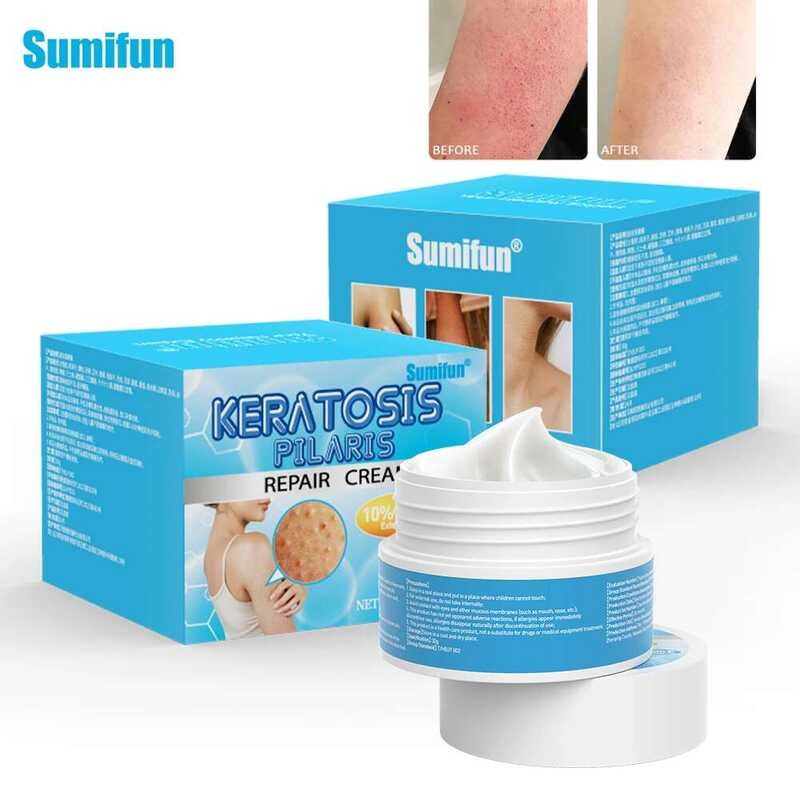 Tt 5Pc Keratosis Pil Repair Cream Clear Spots Tanggalin Ang Chicken ...