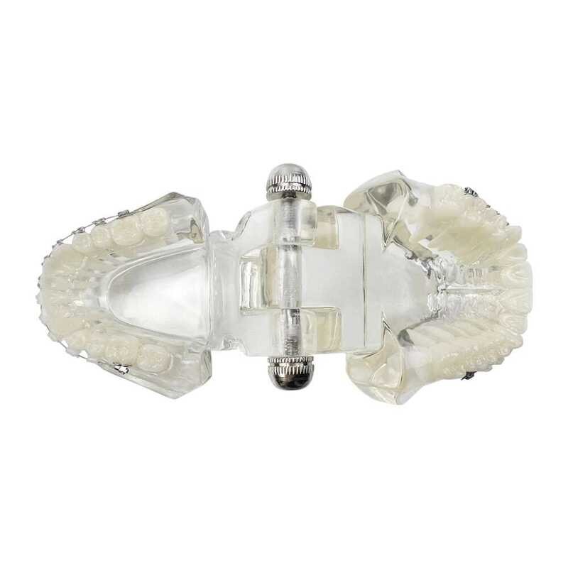 Implant Orthodontic Gum Tooth Models Metal Ceramic Braces Resin ...