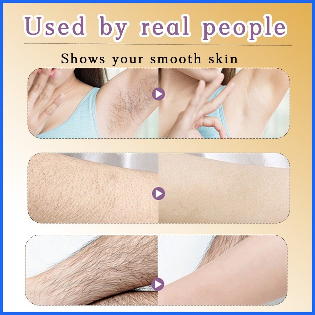 ↕ ∱ ROCEY LADY Hair Removal Kit Painless and silky for armpit hair ...