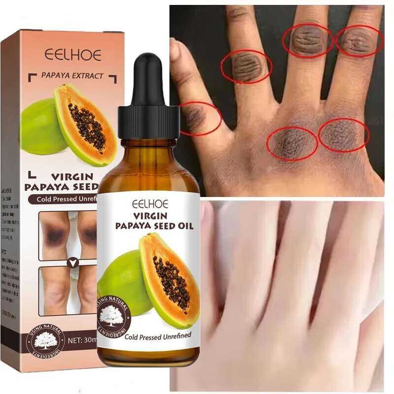 New Dark Knuckles Fast Brighten Serum Elbows Hand Knuckle Brightening ...