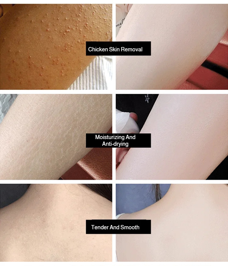 Rapid penetration Hair follicle net Follicle Purifying Cream Treatment ...