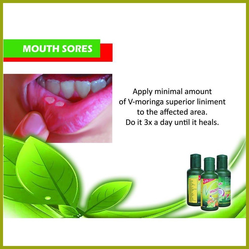 V MORINGA Liniment Herbal Oil VMoringa Body Massage Pain Reliever ...