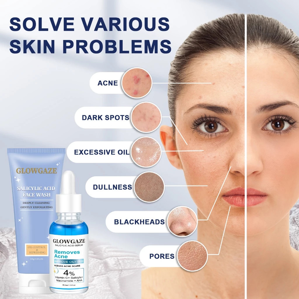 【BUY 1 TAKE 2】GLOWGAZE Emergency Acne Kit 2-in-1 Salicylic Acid Essence ...