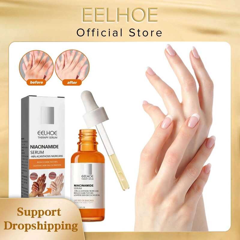 Dark Knuckles Whitening Serum Dark Knees Elbow Lightening Pigmentation ...