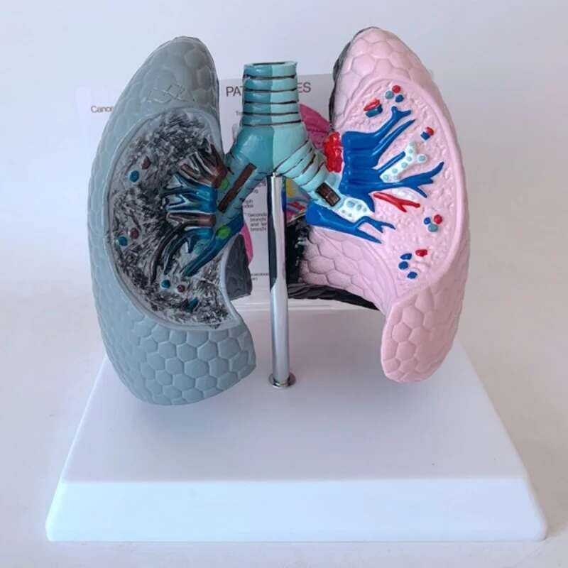 Human 1 Anatomical Model Of Smoking And Healthy Lung | Shopee Philippines