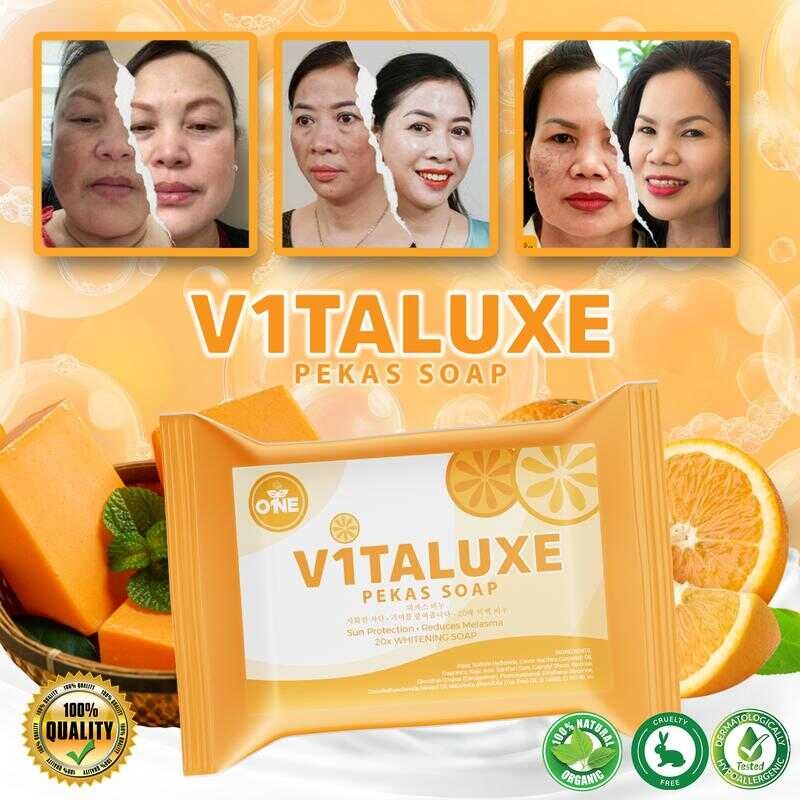 V1taluxe Pekas Soap Korea (100G) - Dark Spots, Melasma, Pekas ...