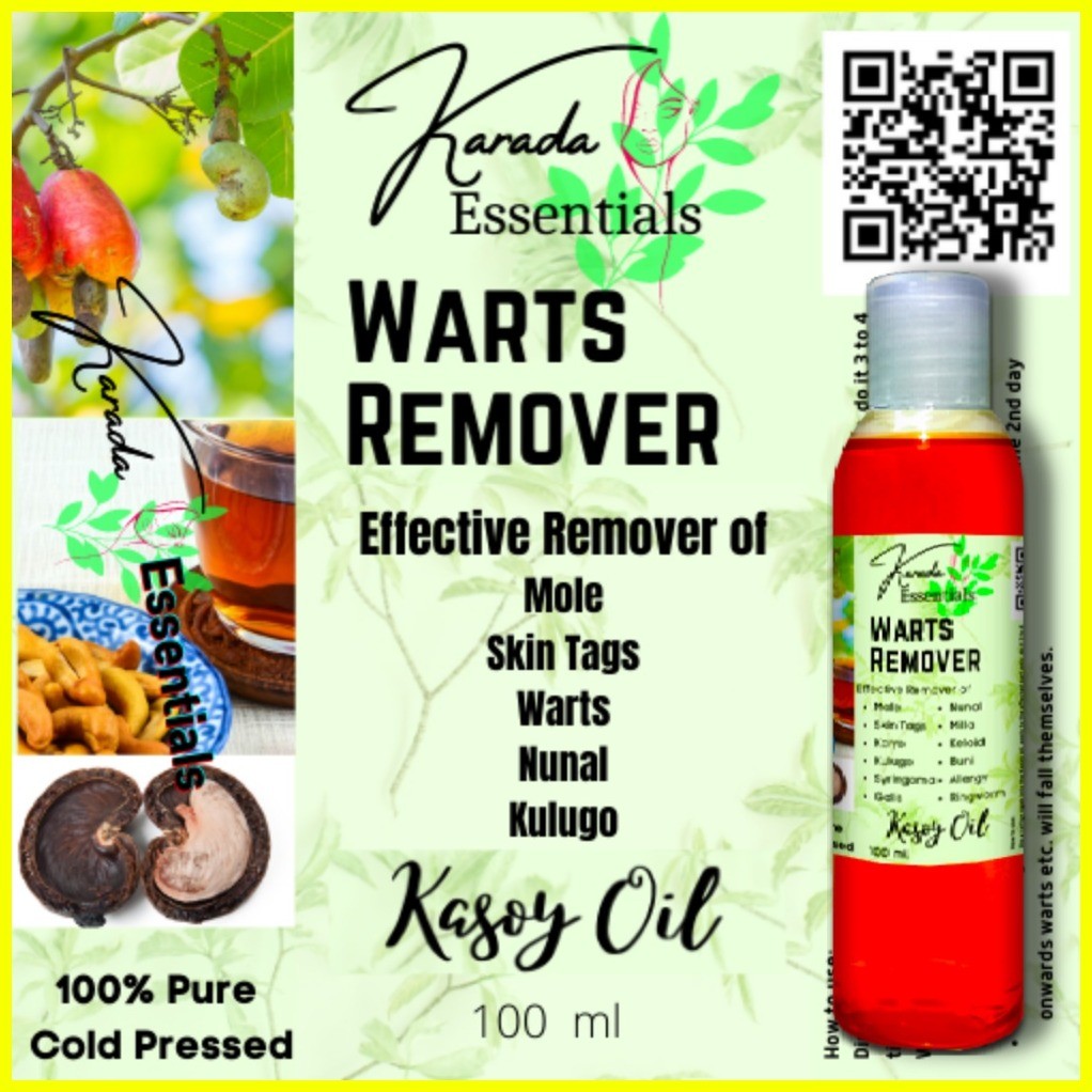 Nunal Warts remover kasoy oil original | Shopee Philippines