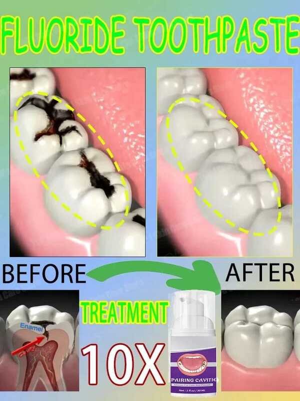 Toothpaste Of Teeth Whitening Repair Of Cavities Caries Removal Of ...