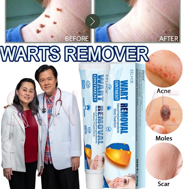 Warts Remover Original Cream 20g Natural Herbal Ingredients Warts ...