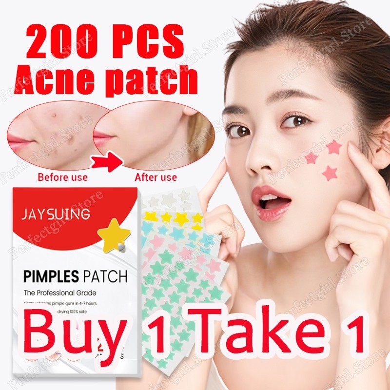 200patches Star Shaped Acne Removal Pimple Patches Facial Care Stickers ...
