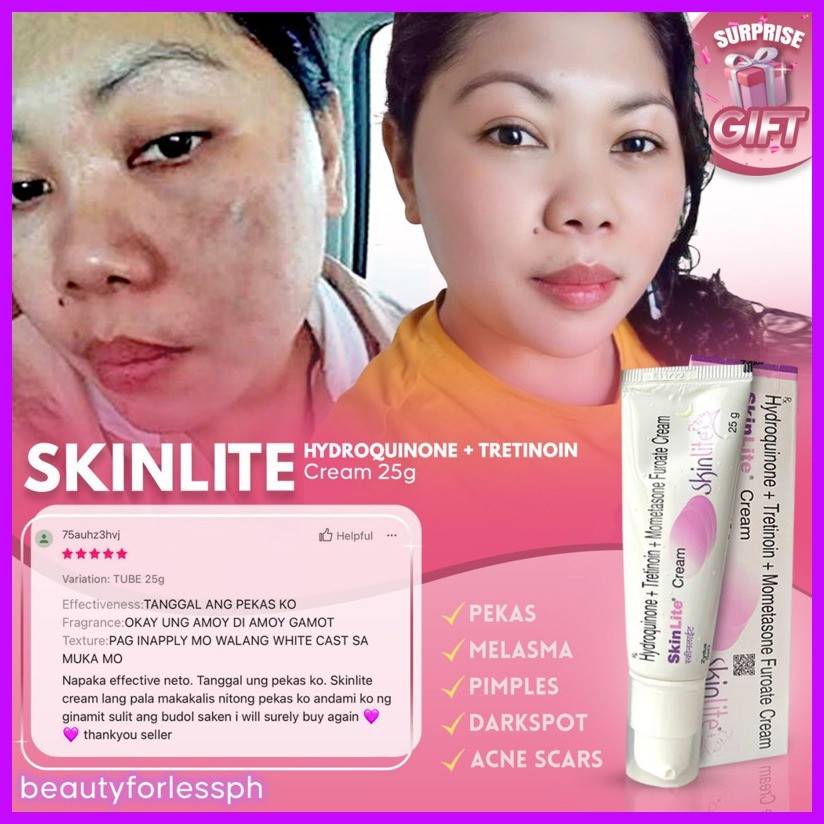 AUTHENTIC Skinlite Cream Melasma Remover Pekas eraser melasma cream ...