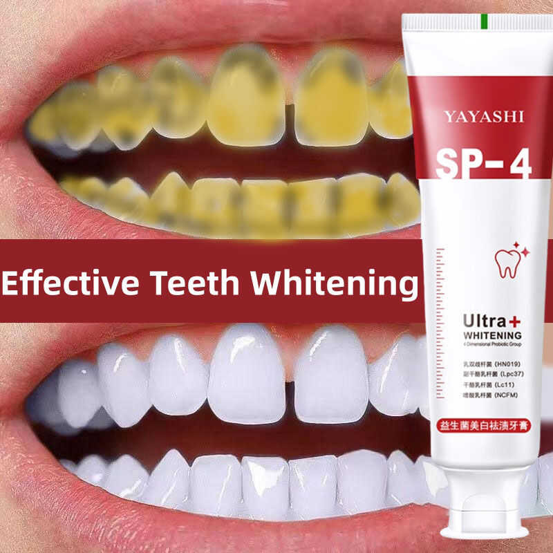 Probiotic Toothpaste Sp-4 Brightening Whitening Remove Tooth Stains ...