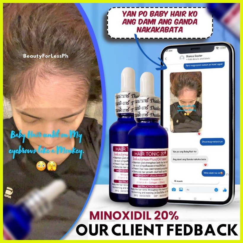 ↂ ⚠ AUTHENTIC WITH THAILAND SEAL! Minoxidil 15% 20% HAIR TONIC Authentic Made in Thailand ...