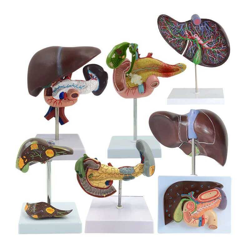 Highly Simulated Anspleen Duodenum Relief Lesion Liver 1 Gallbladder ...