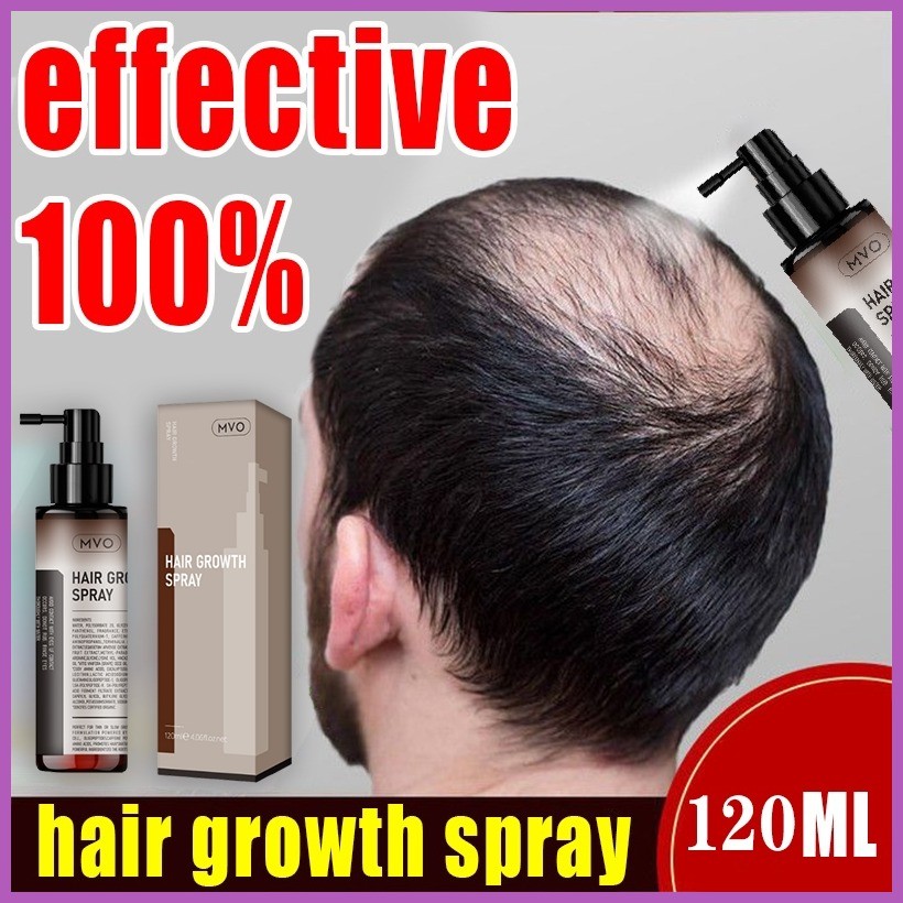 ☂ MVO Novu Hair Grower Pomade For Men Original/Hair Growth Serum Oil ...