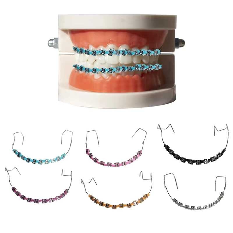 Braces 1 Fashion Pair Colorful Temporary Tooth Decoration With Metal ...