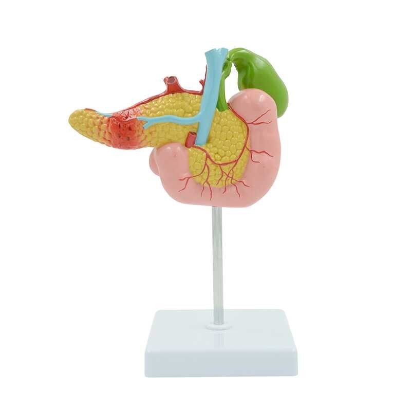 Patologic Model of The Pancreas Duodenum and Gallbladder Human Internal ...
