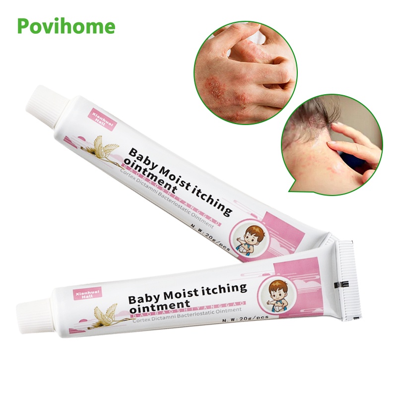 Baby Care Anti-bacterial Cream Soothes Eczema Pruritus Dermatitis ...