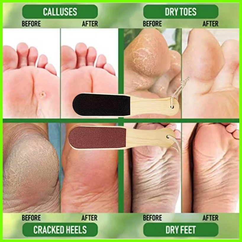 2in1 Callus Remover Foot Scrub Tanggal Kalyo Sa Paa Foot File Foot Care ...