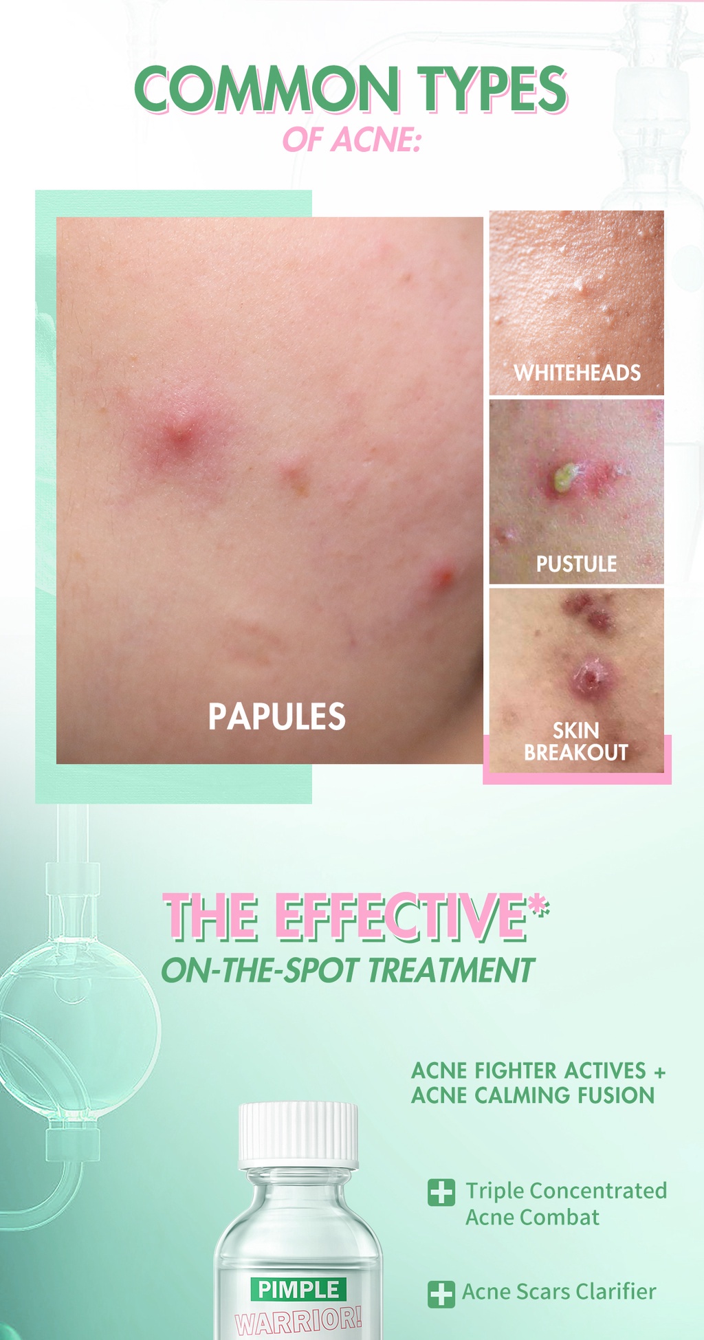 barenbliss BNB Pimple Warrior Salicylic Acid Acne Drying Lotion Triple ...