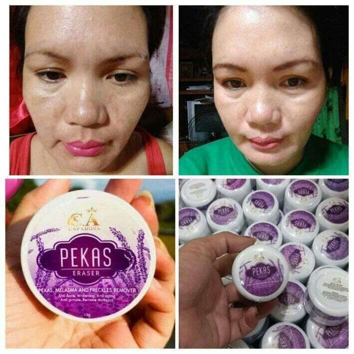 Orihinal Na Eraser Cream 10g Sa Pamamagitan Ng Capadosa Pekas Melasma