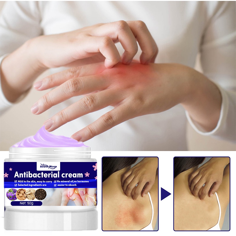 Psoriasis Antibacterial Cream Dermatitis Eczematoid Ointment Effective ...