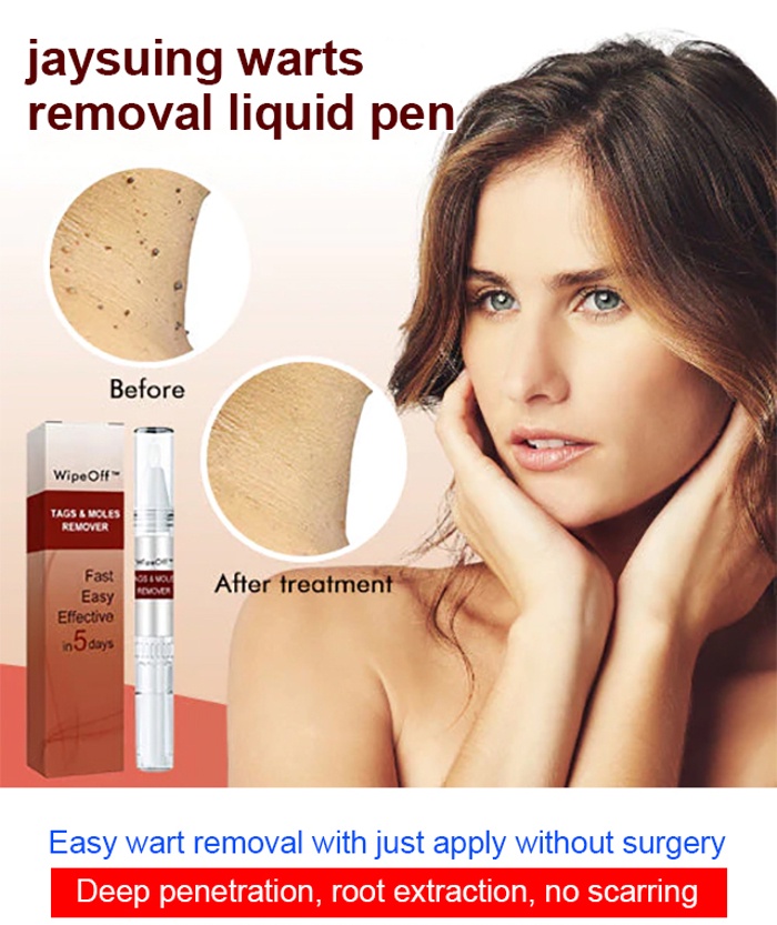 wart liquid pen mole removal care pen wart acuminata thorn filiform ...
