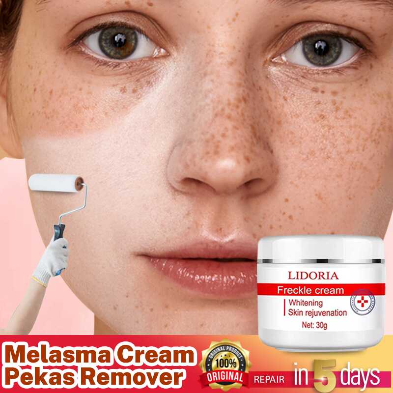 japanese collagen melasma cream melasma remover from japan biora super ...