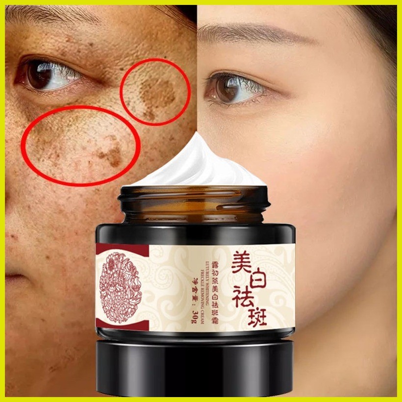 Dark Spot Remover Brightest Skin Anti Aging Pekas Remover Original ...