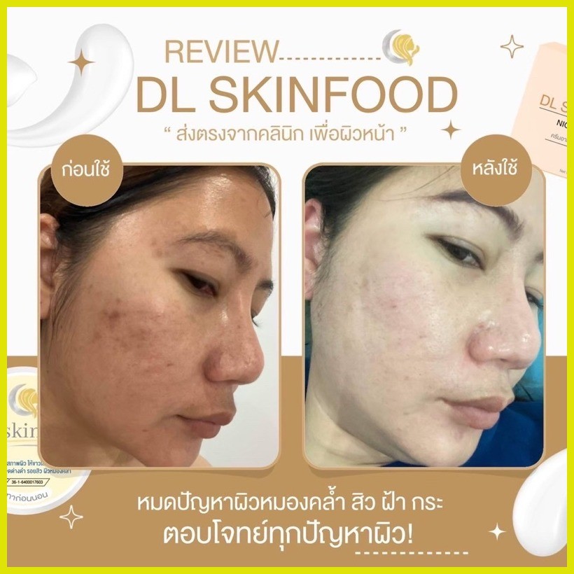 ♒ ☾ DELI SKIN NIGHT CREAM FOR ACNES/MELASMA/ DULL SKIN FROM THAILAND ...
