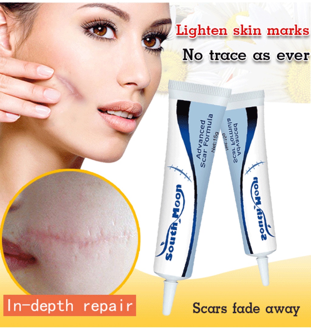 Get Rid of Scars with Scar Repair Gel for Burns and Wounds | Shopee ...