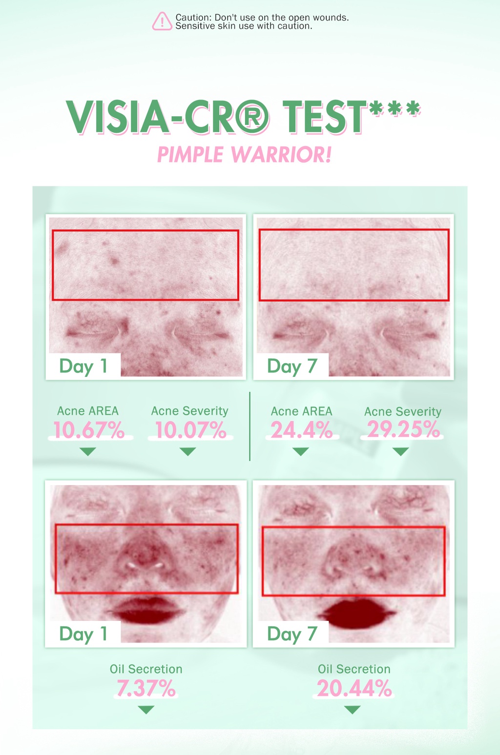Pimple Warrior Salicylic Acid Acne Drying Lotion Triple Concentrated ...