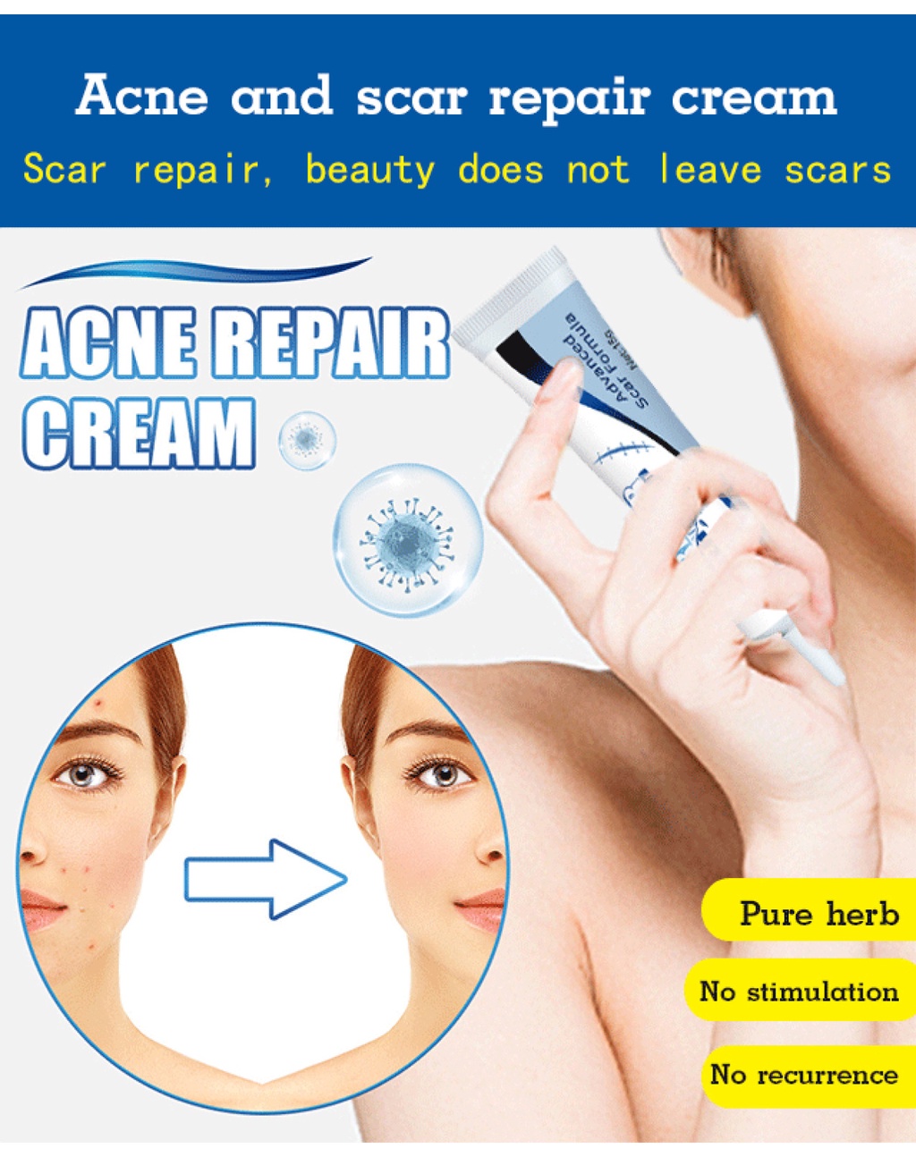 Get Rid of Scars with Scar Repair Gel for Burns and Wounds | Shopee ...