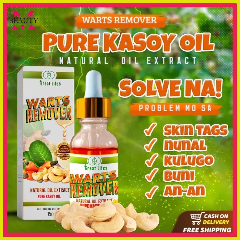 ♈ Kasoy Oil Effective Warts Remover Epektibong Pantagal ng Kulugo, Skin ...