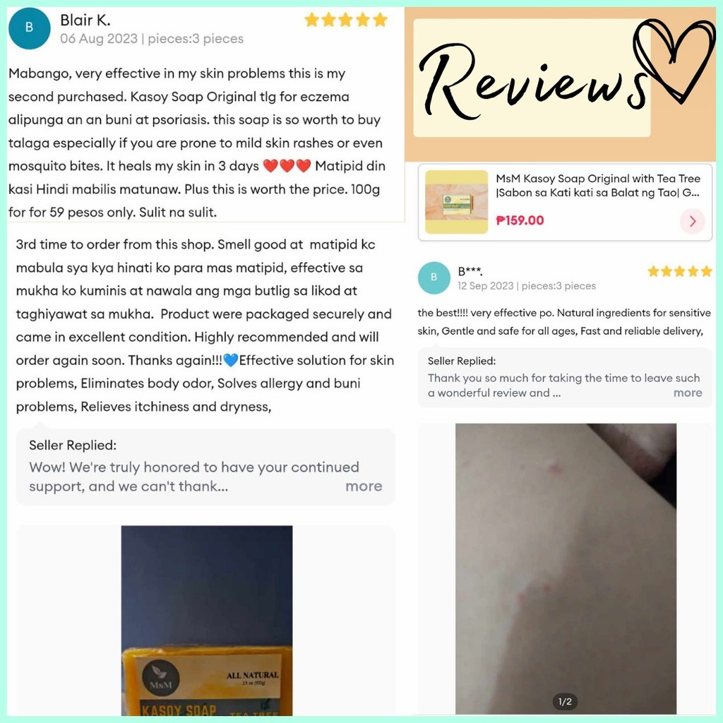 © Sabon sa Kati Kati |An An Remover Kasoy Soap: Skin Disease Treatment ...